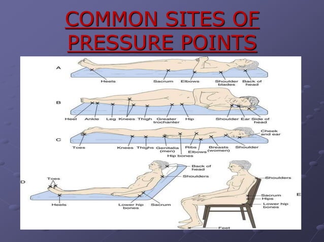 Common pressure points | PPTX