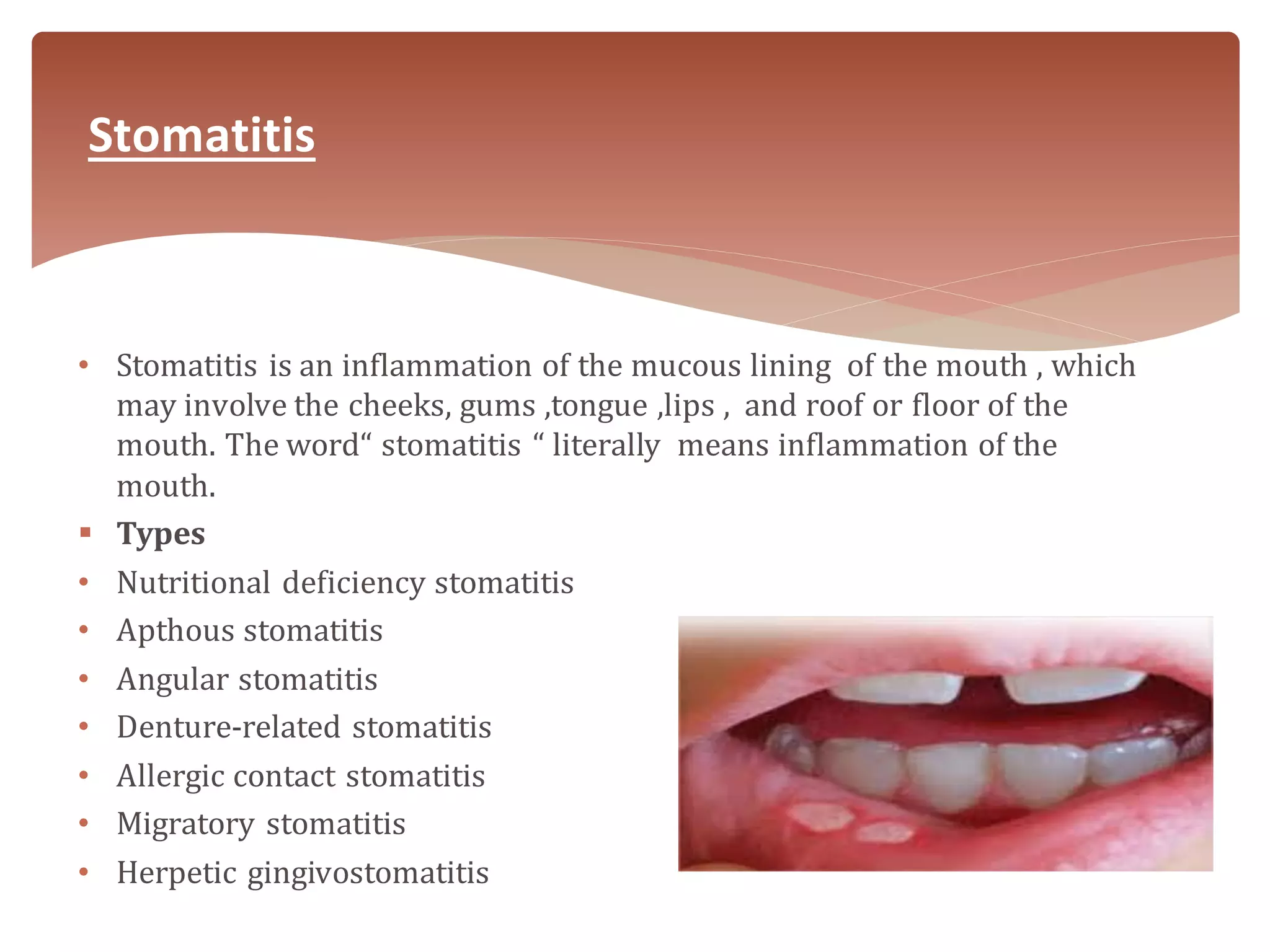 Common problems associated with Oral cavity | PDF