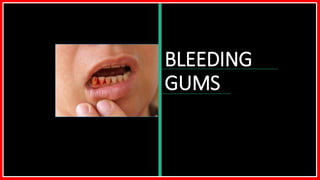 Common problems of oral cavity | PPTX