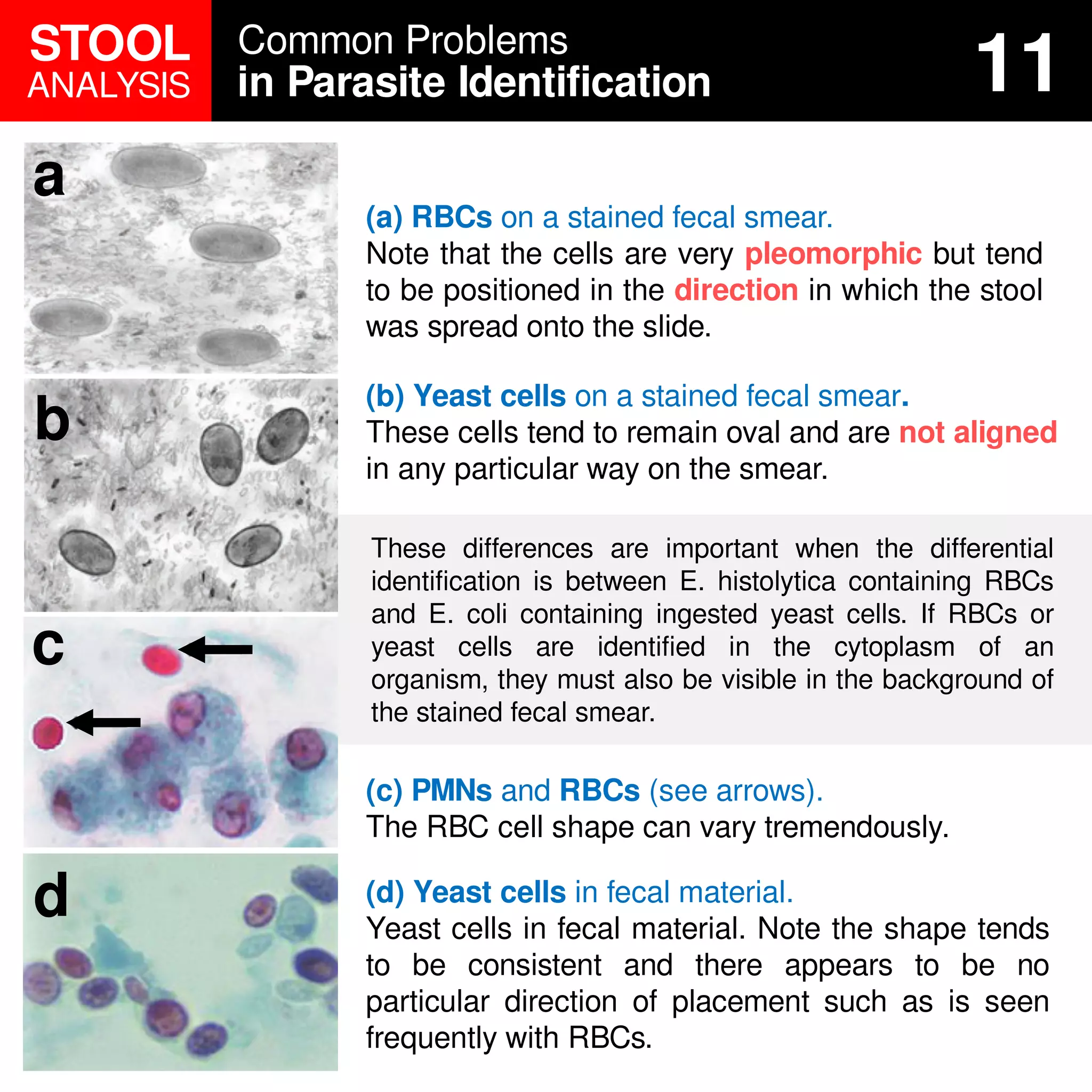 Common problems of parasites identification in stool analysis | PDF