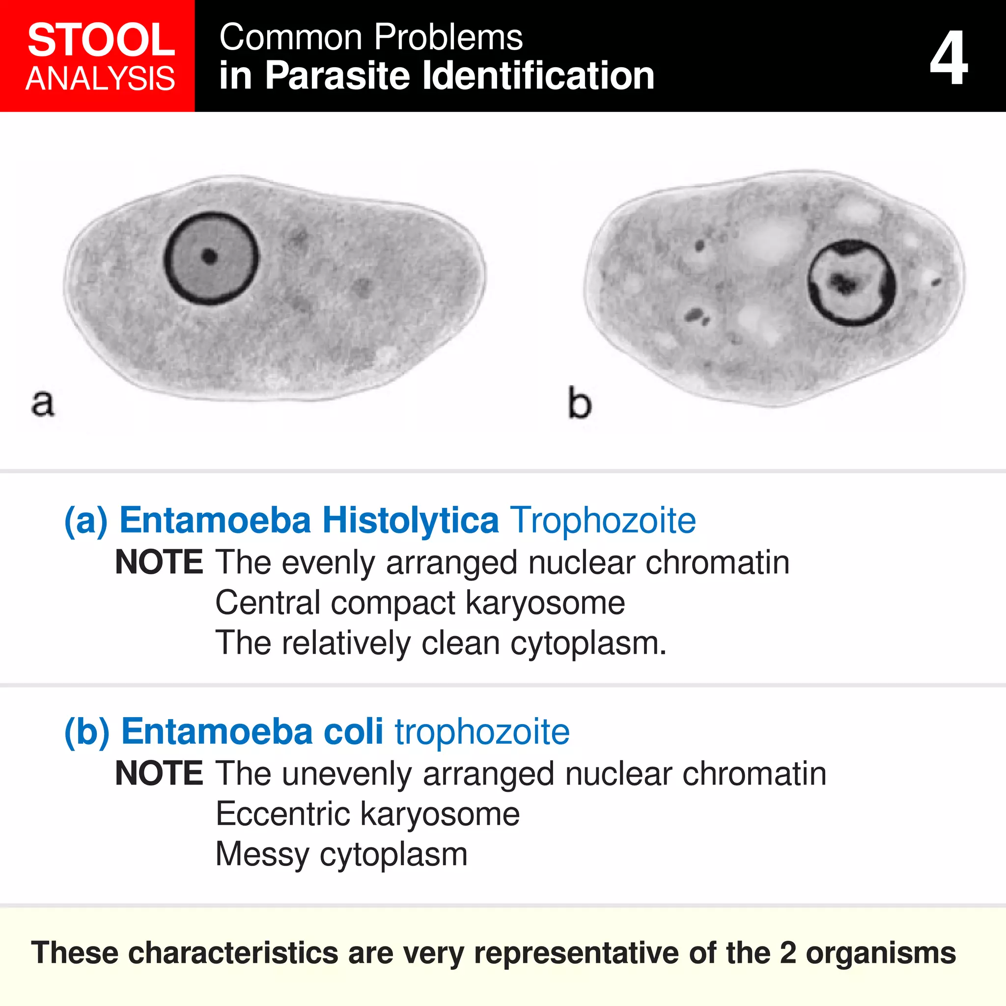 Common problems of parasites identification in stool analysis | PDF