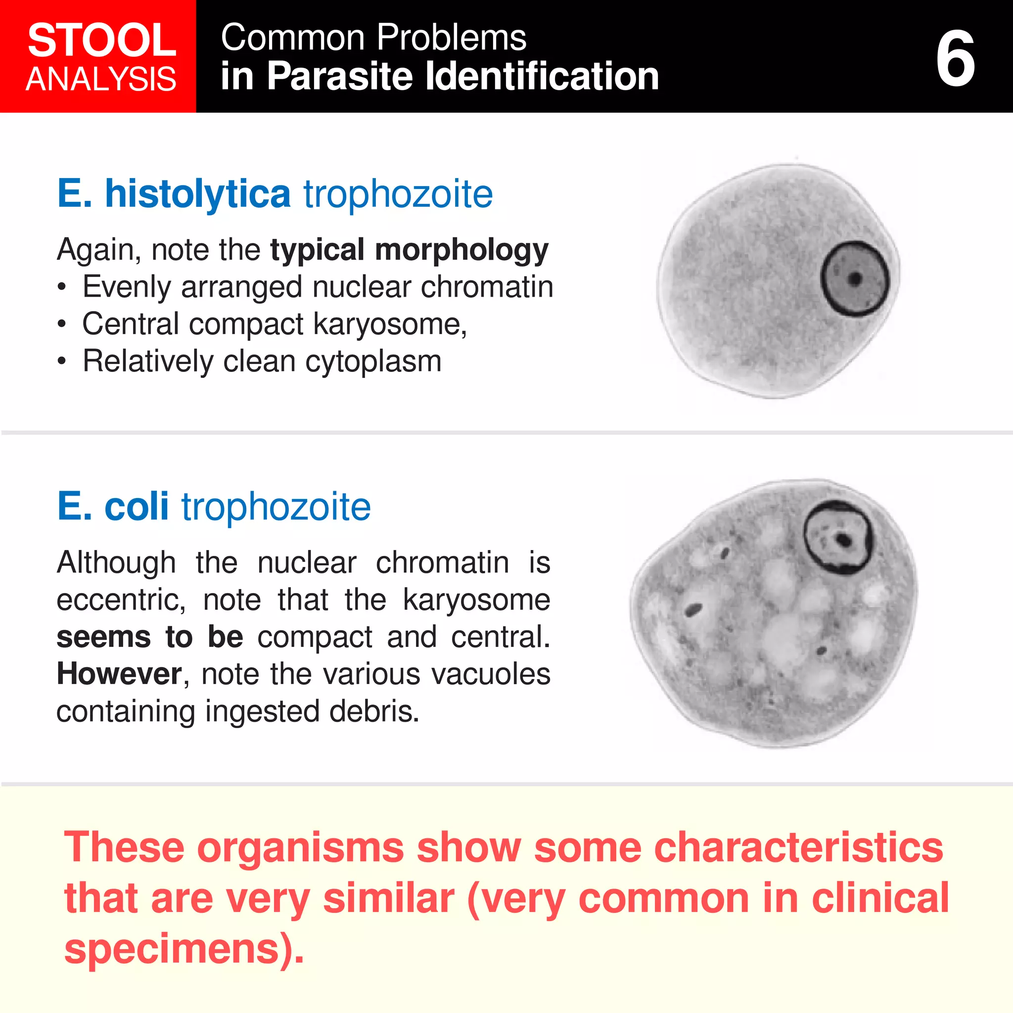 Common problems of parasites identification in stool analysis | PDF