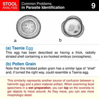 Common problems of parasites identification in stool analysis | PDF