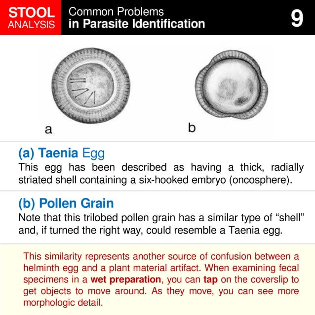 Common problems of parasites identification in stool analysis | PDF