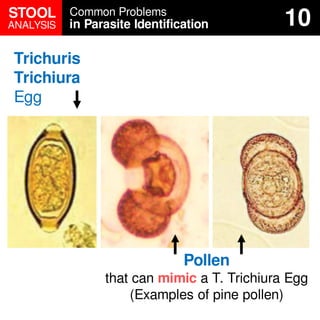 Common problems of parasites identification in stool analysis | PDF