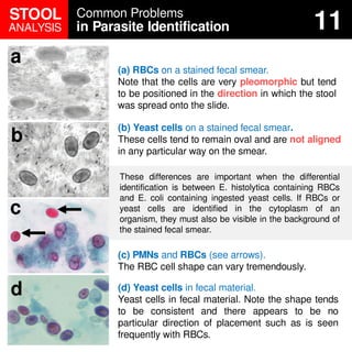 Common problems of parasites identification in stool analysis | PDF
