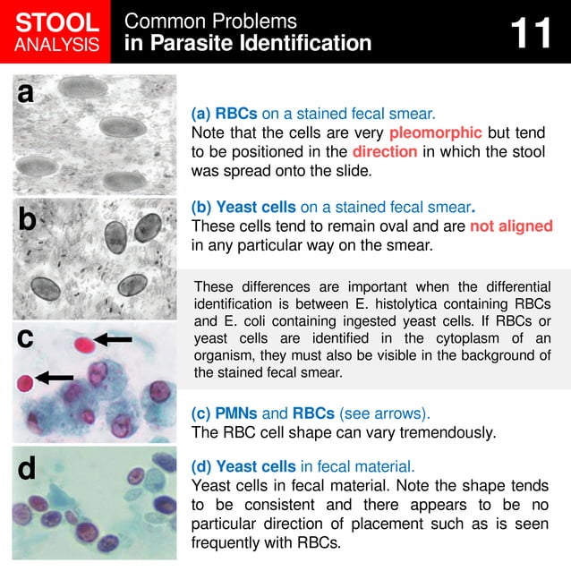 Common problems of parasites identification in stool analysis | PDF