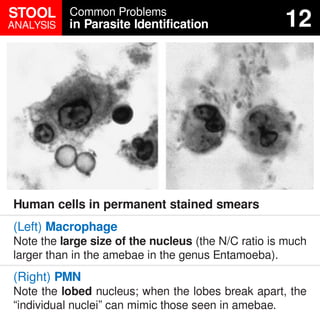 Common problems of parasites identification in stool analysis | PDF