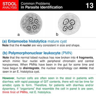 Common problems of parasites identification in stool analysis | PDF