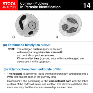 Common problems of parasites identification in stool analysis | PDF
