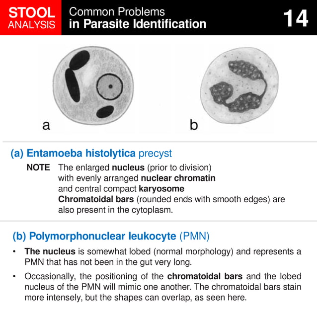 Common problems of parasites identification in stool analysis | PDF