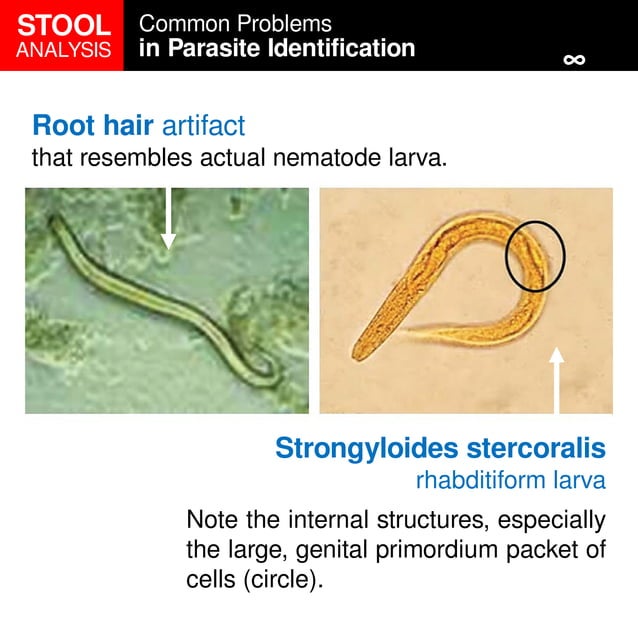 Common problems of parasites identification in stool analysis | PDF