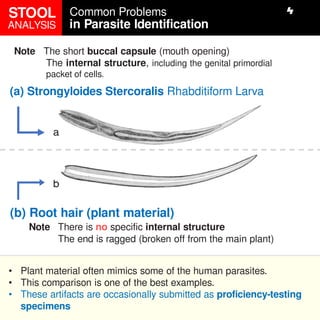 Common problems of parasites identification in stool analysis | PDF