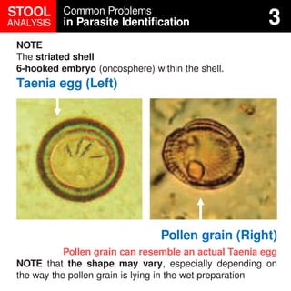Common problems of parasites identification in stool analysis | PDF