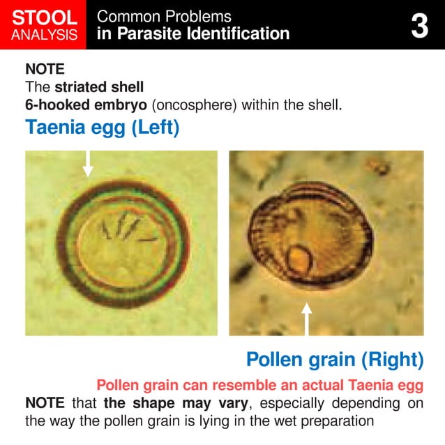 Common problems of parasites identification in stool analysis | PDF