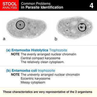 Common problems of parasites identification in stool analysis | PDF