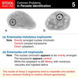 Common problems of parasites identification in stool analysis | PDF