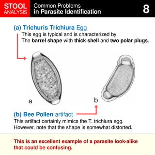 Common problems of parasites identification in stool analysis | PDF