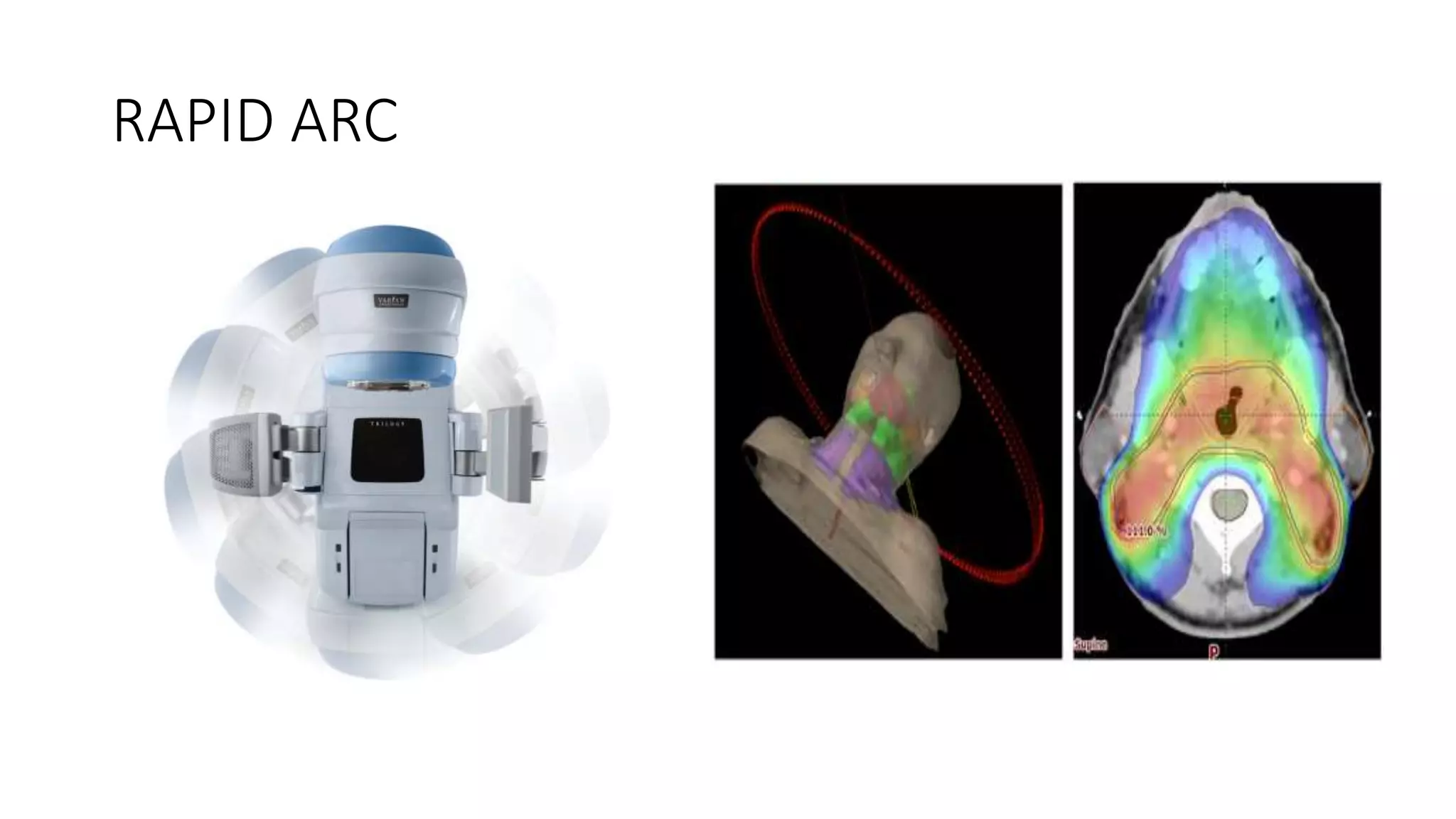 Common Radiation Therapy Facts and Myths.pptx