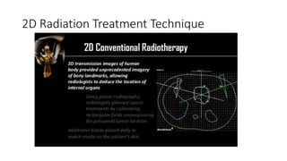 Common Radiation Therapy Facts and Myths.pptx