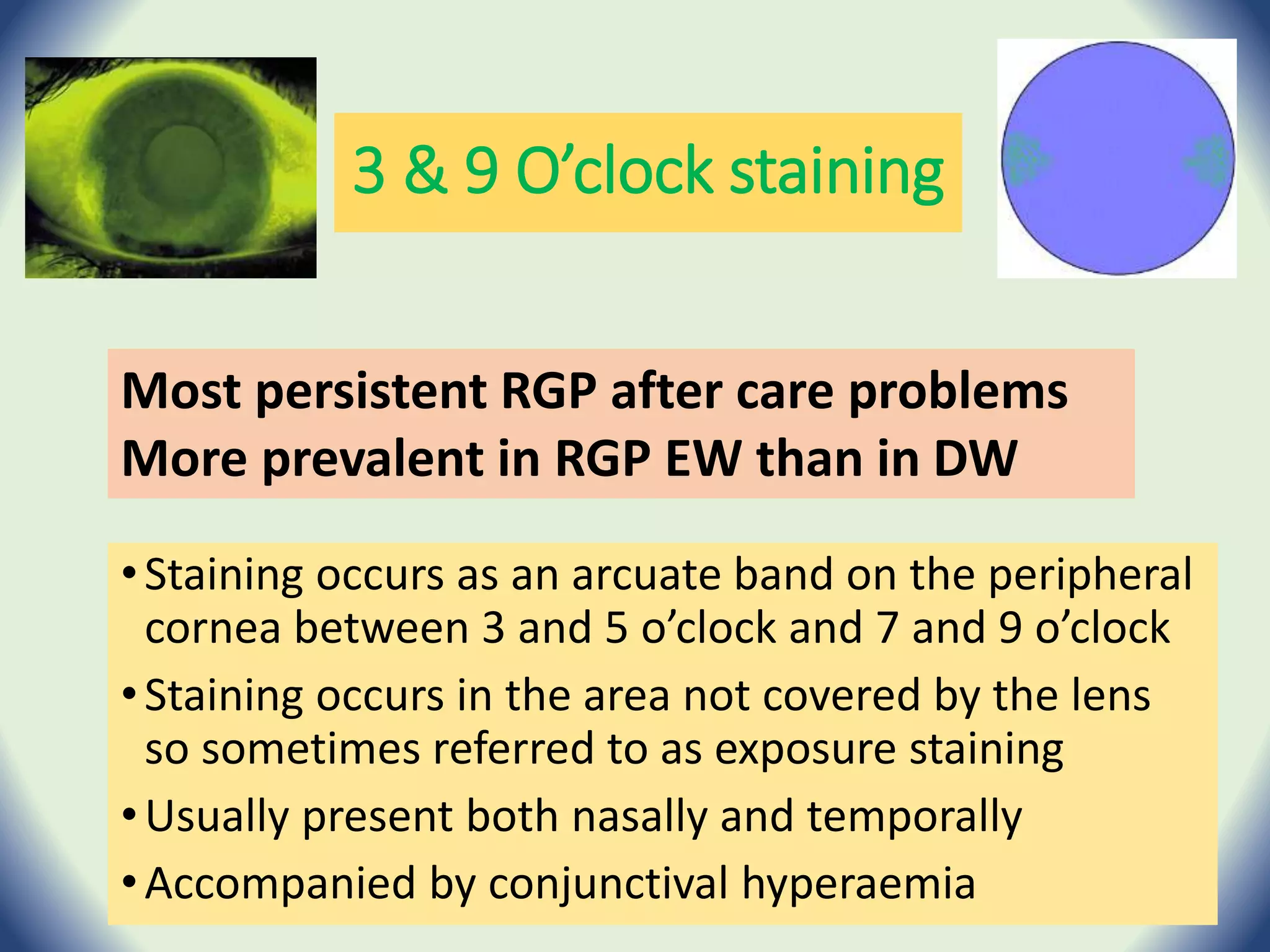 RGP Complications | PPTX