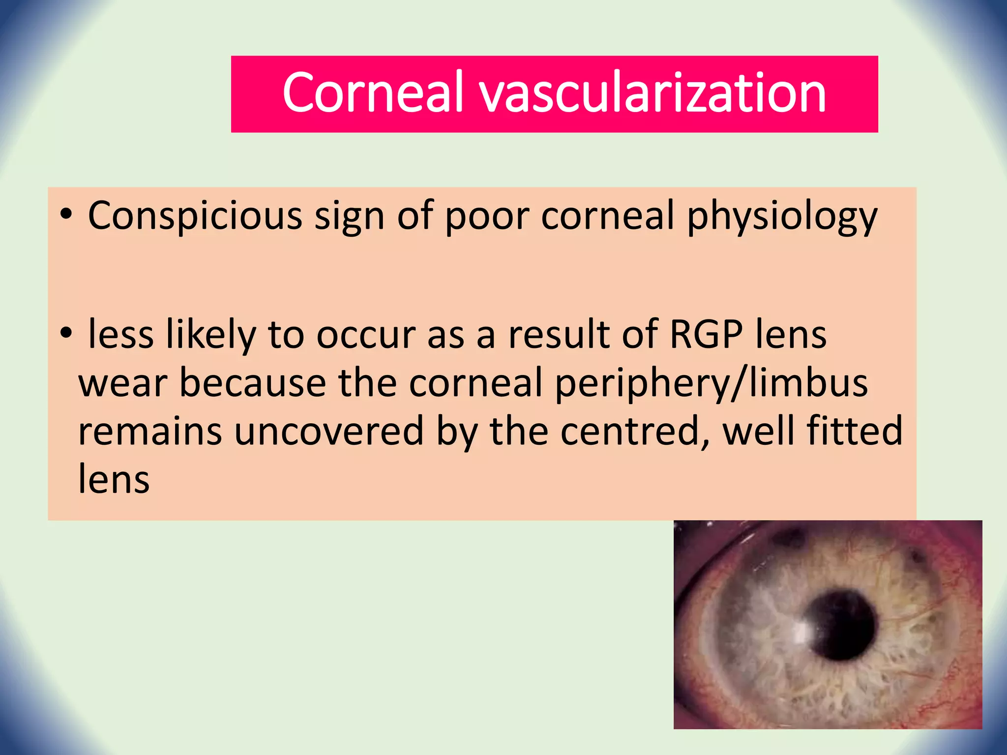RGP Complications | PPTX | Eye and Vision Conditions | Diseases and Conditions