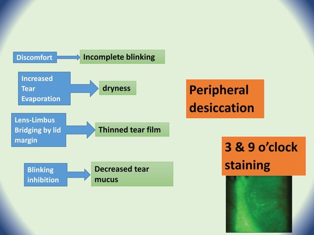 RGP Complications | PPTX | Eye and Vision Conditions | Diseases and Conditions