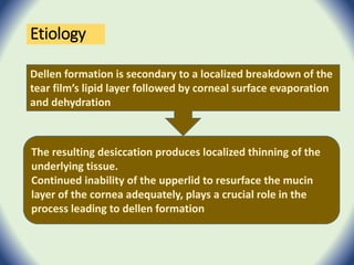 RGP Complications | PPTX