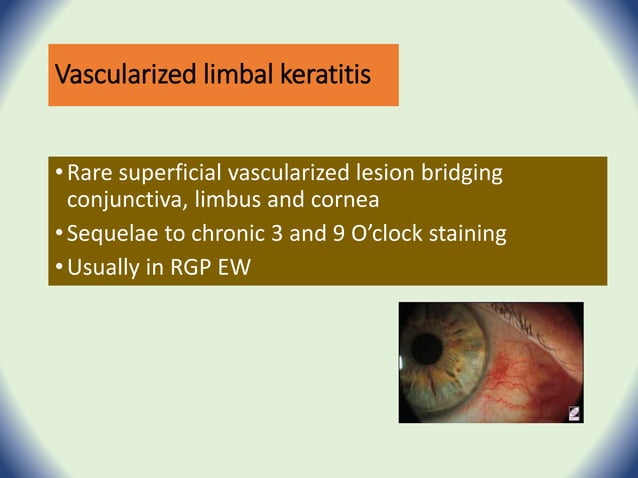 RGP Complications | PPTX | Eye and Vision Conditions | Diseases and Conditions