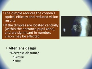 RGP Complications | PPTX