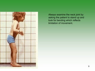 Common Rheumatic Disease In Children Ppt