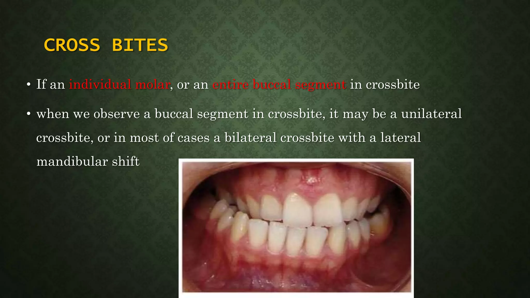 Common sense mechanics | PPTX