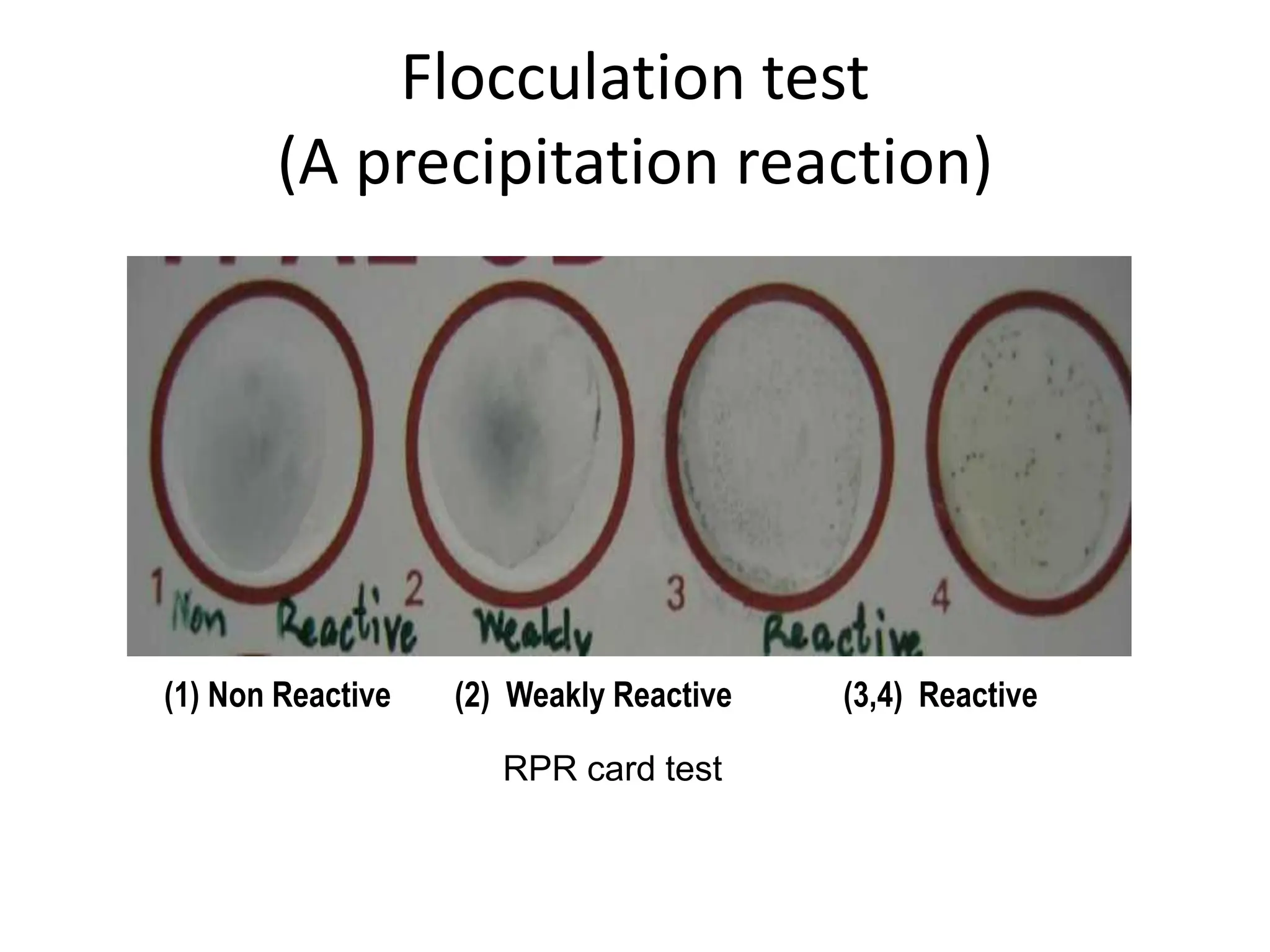 Common serology tests and their problems..pdf