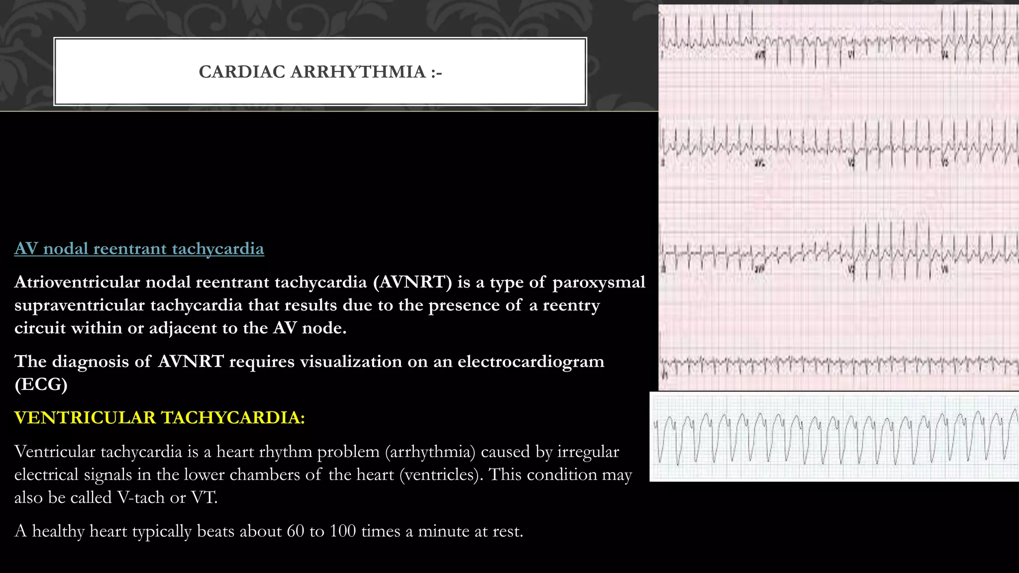 COMMON SIGNS & ABNORMALITIES _CAN DETECT IN CARDIAC MONITOR.pptx