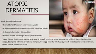 common skin condition in children..pptx