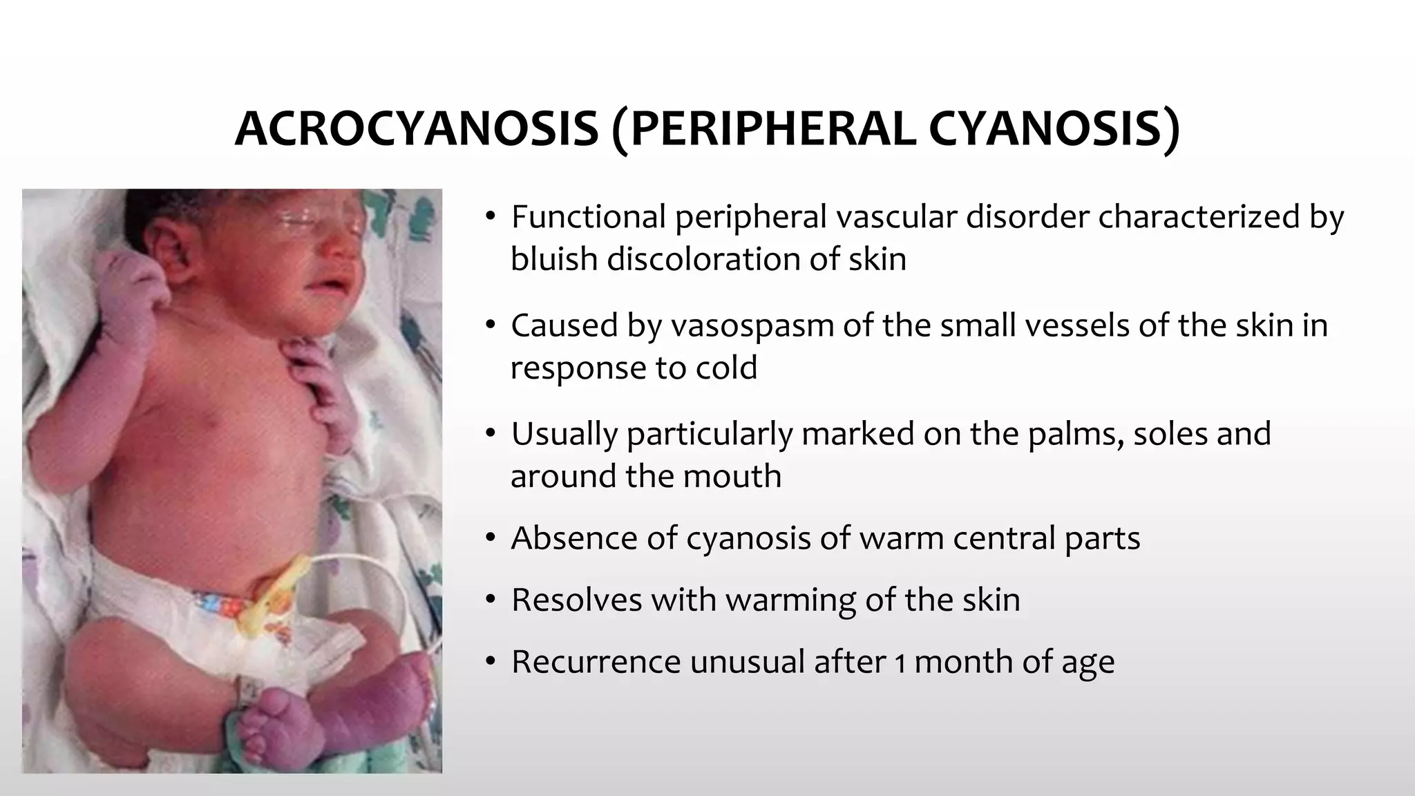 Common skin conditions in neonates | PPTX