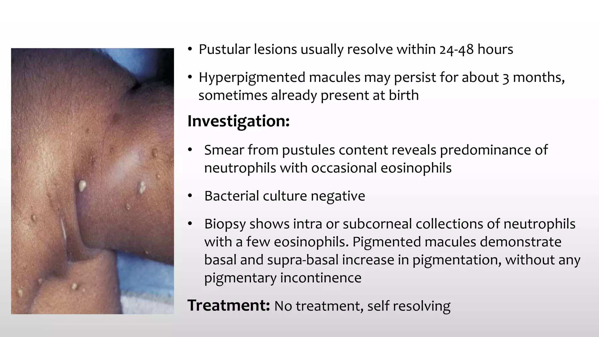 Common skin conditions in neonates | PPTX