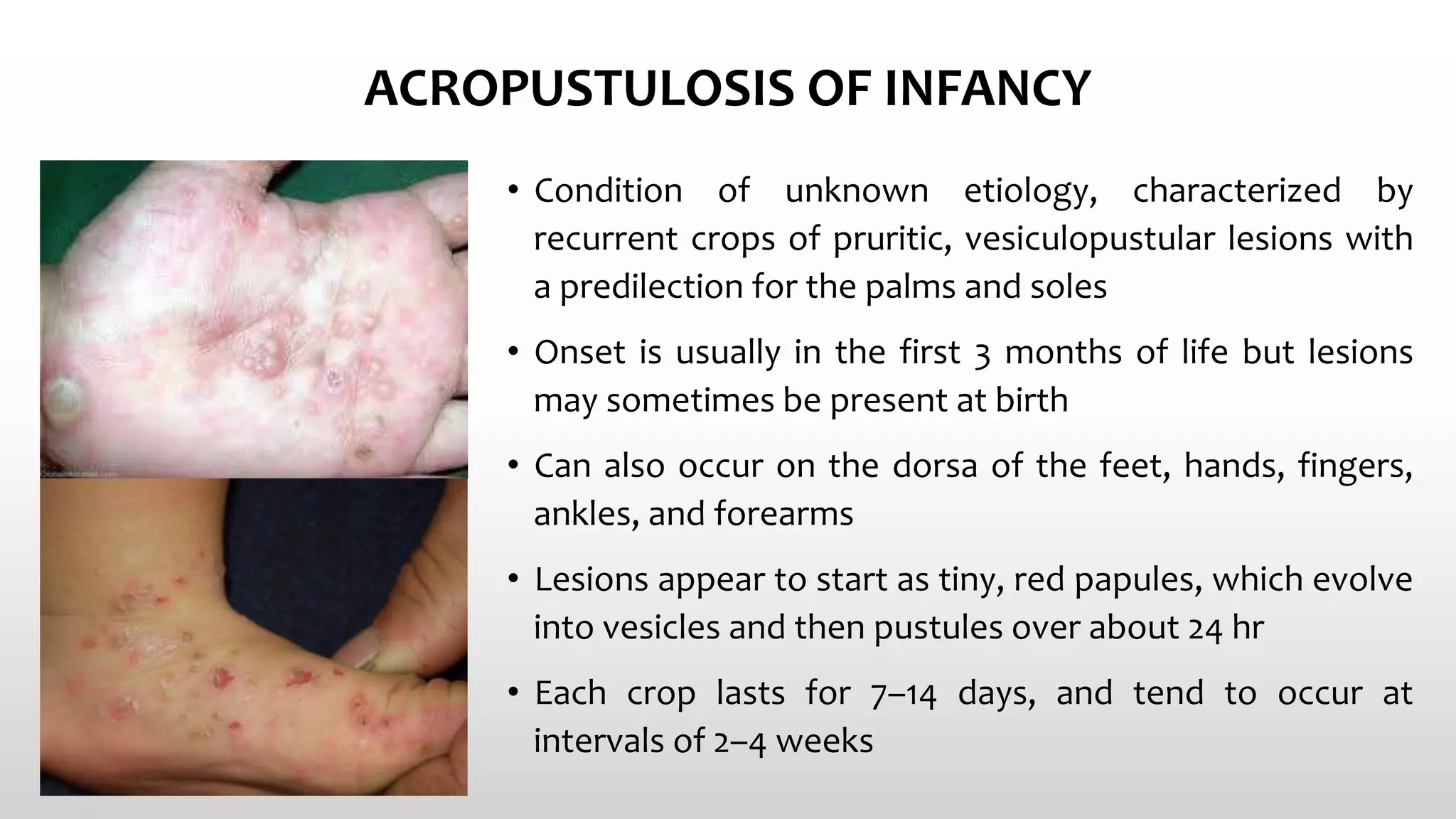 Common skin conditions in neonates | PPTX
