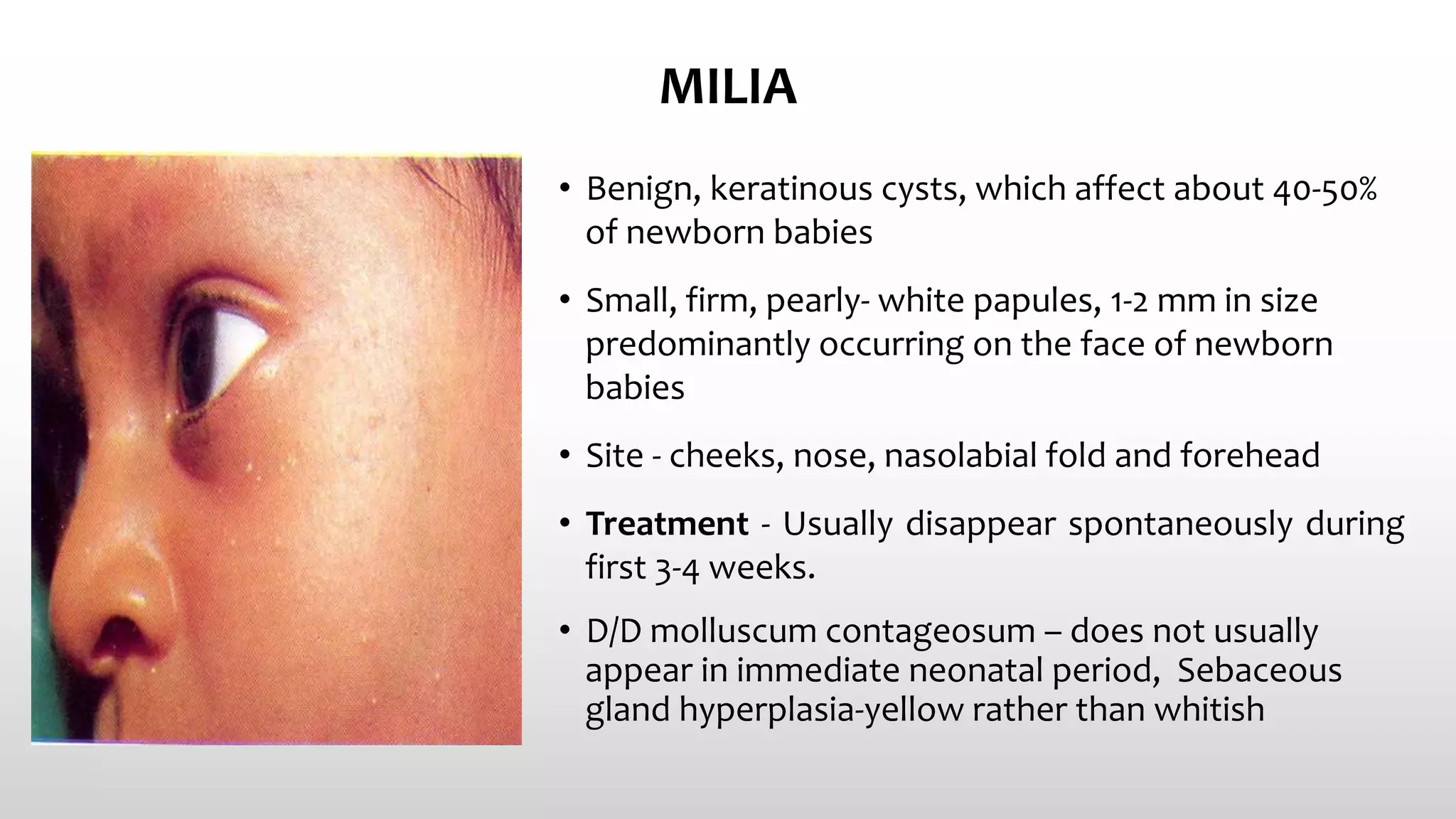 Common skin conditions in neonates | PPTX