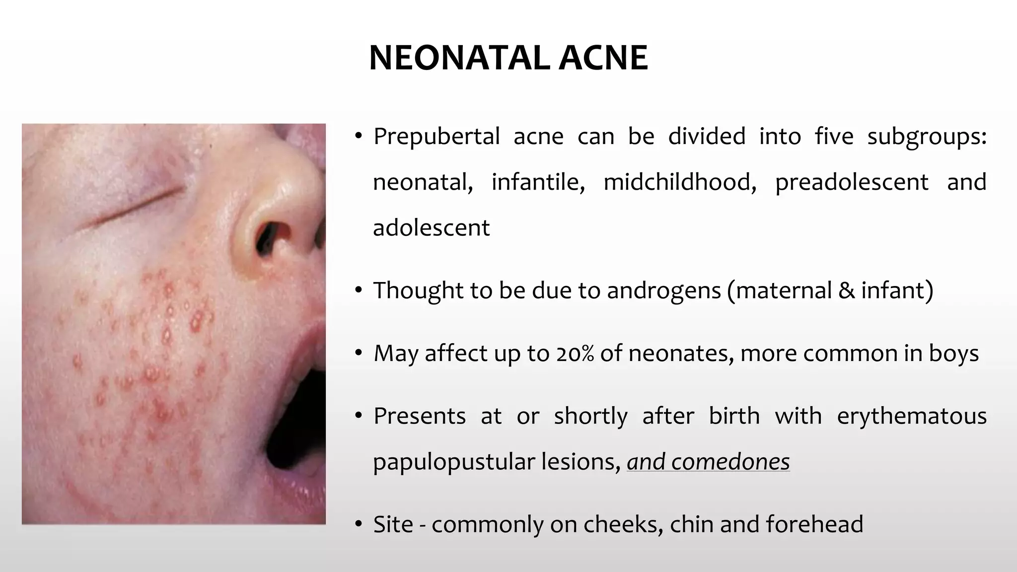 Common skin conditions in neonates | PPTX
