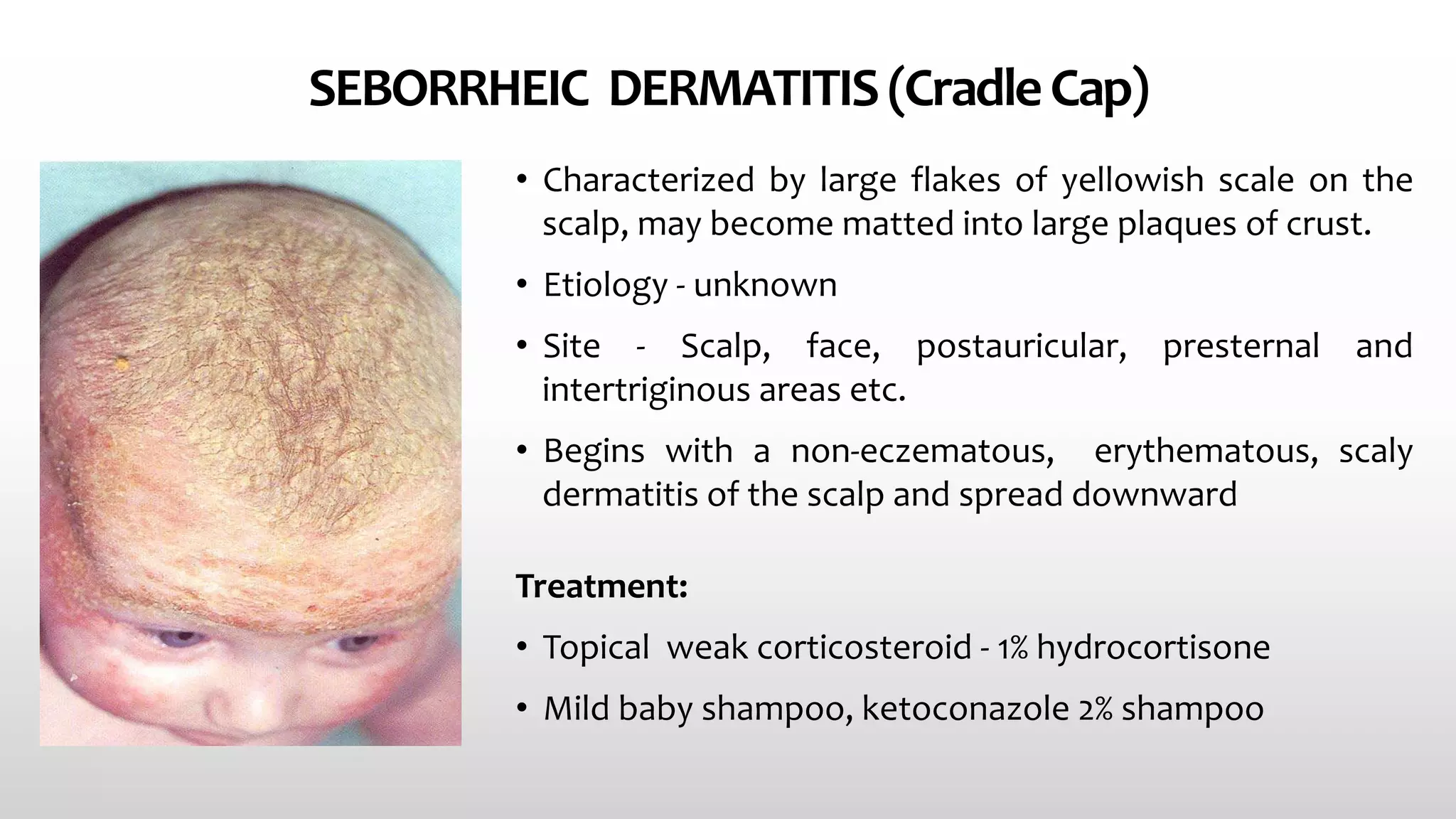 Common skin conditions in neonates | PPTX