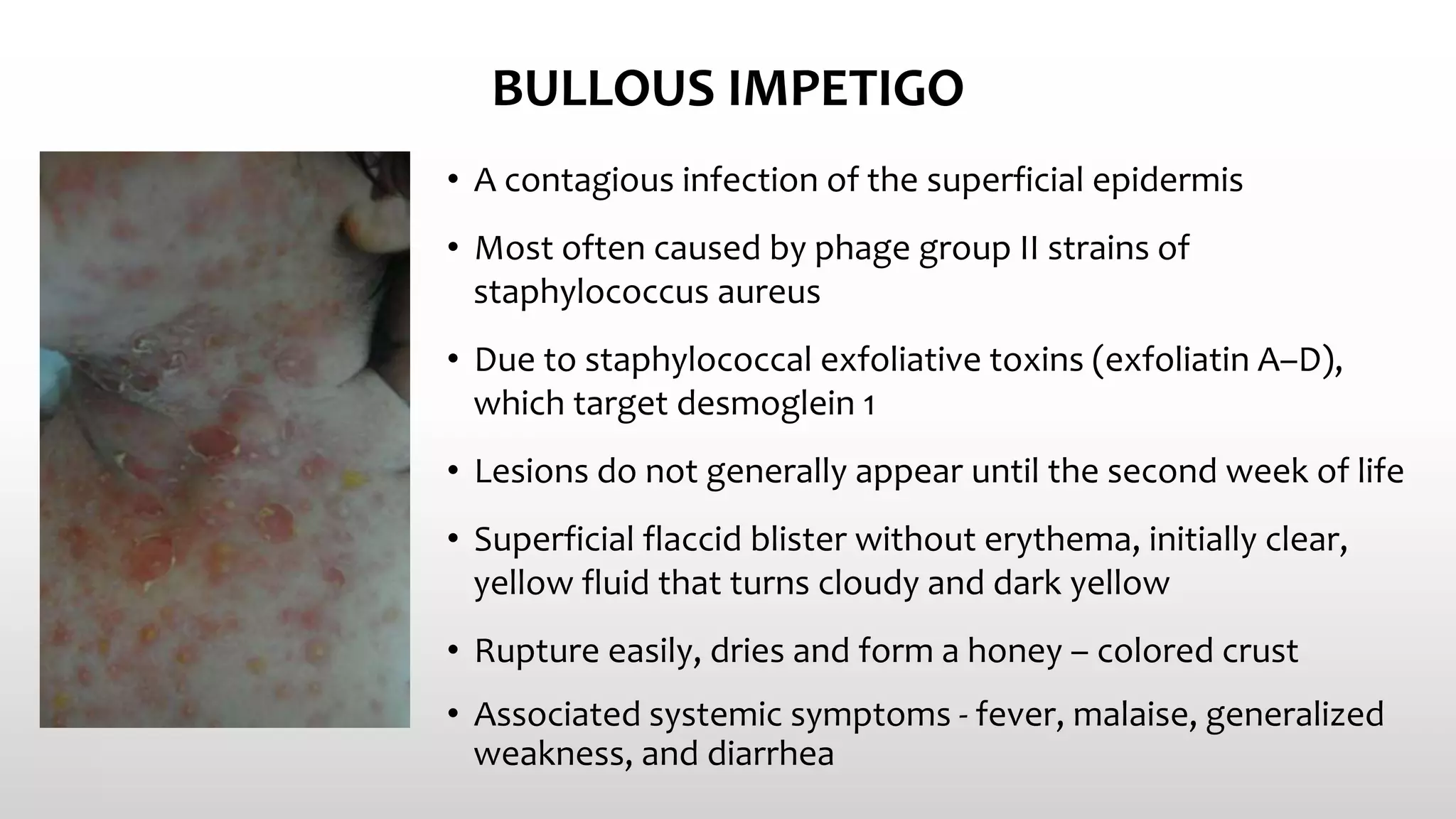 Common skin conditions in neonates | PPTX