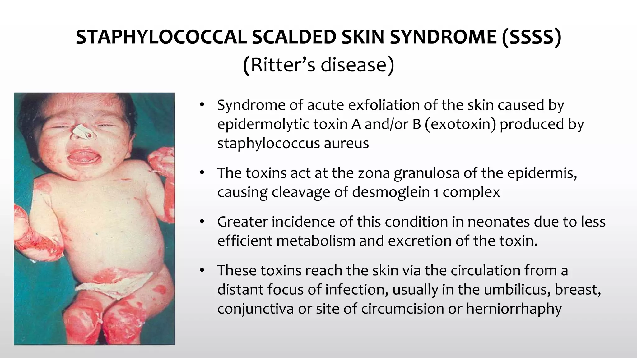 Common skin conditions in neonates | PPTX
