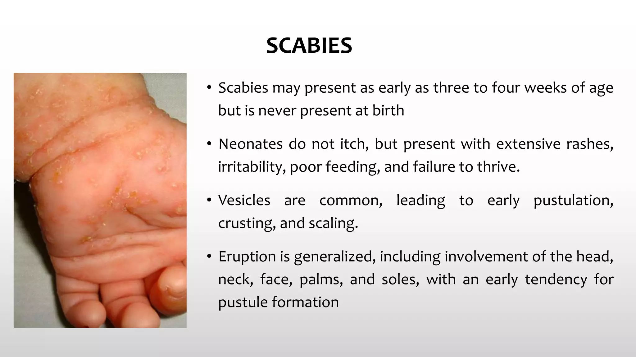 Common skin conditions in neonates | PPTX