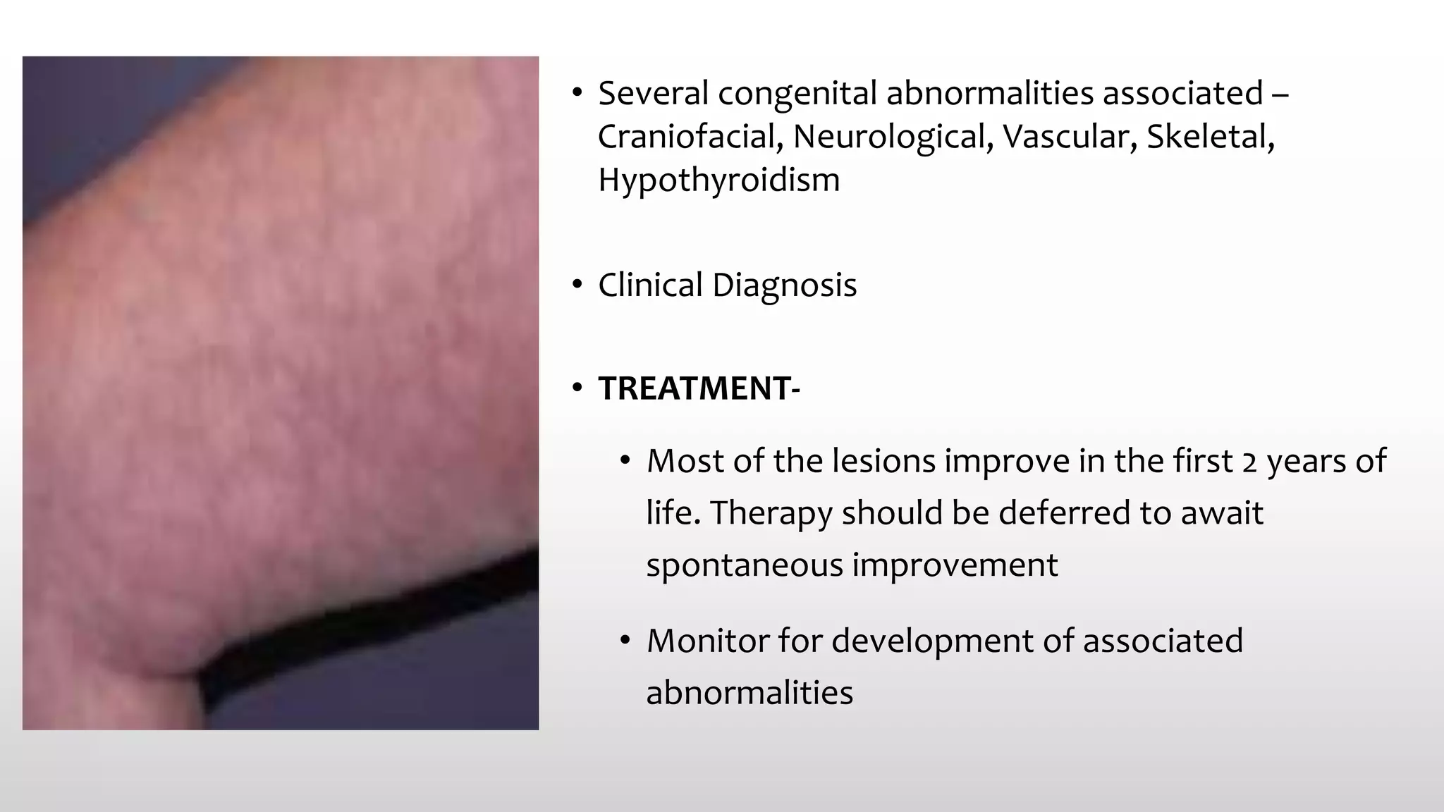 Common skin conditions in neonates | PPTX