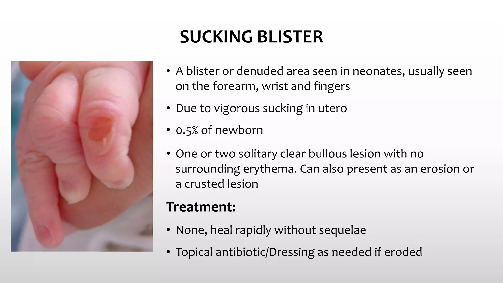 Common skin conditions in neonates | PPTX