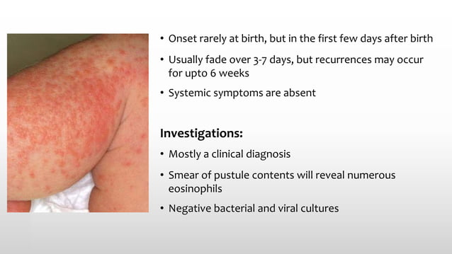 Common skin conditions in neonates | PPTX