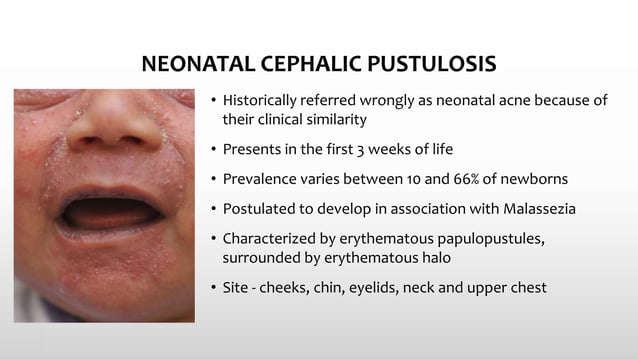 Common skin conditions in neonates | PPTX