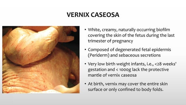Common skin conditions in neonates | PPTX