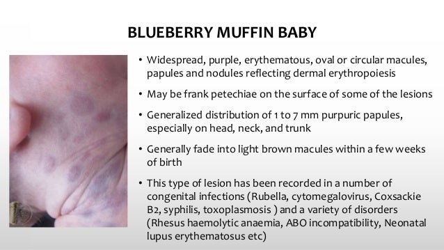 Common skin conditions in neonates